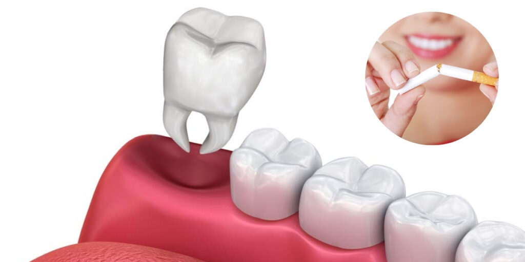 Things to Avoid After Tooth Extraction